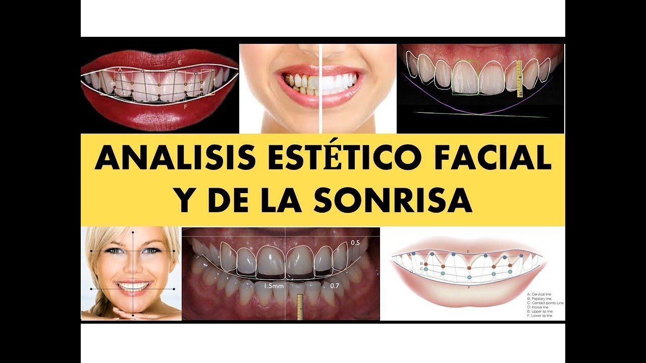 "ANÁLISIS ESTÉTICO FACIAL Y DE LA SONRISA" - YouTube