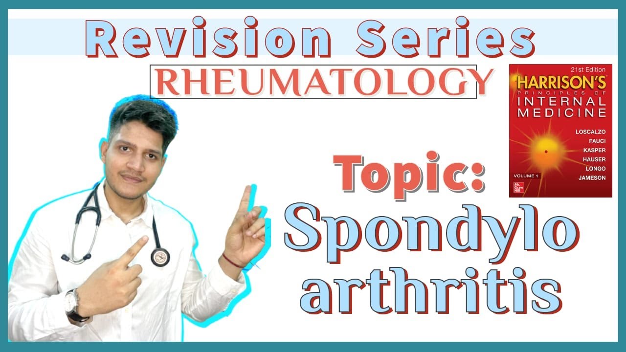 Approach to Arthritis | Spondyloarthritis | Ankylosing Spondylitis ...