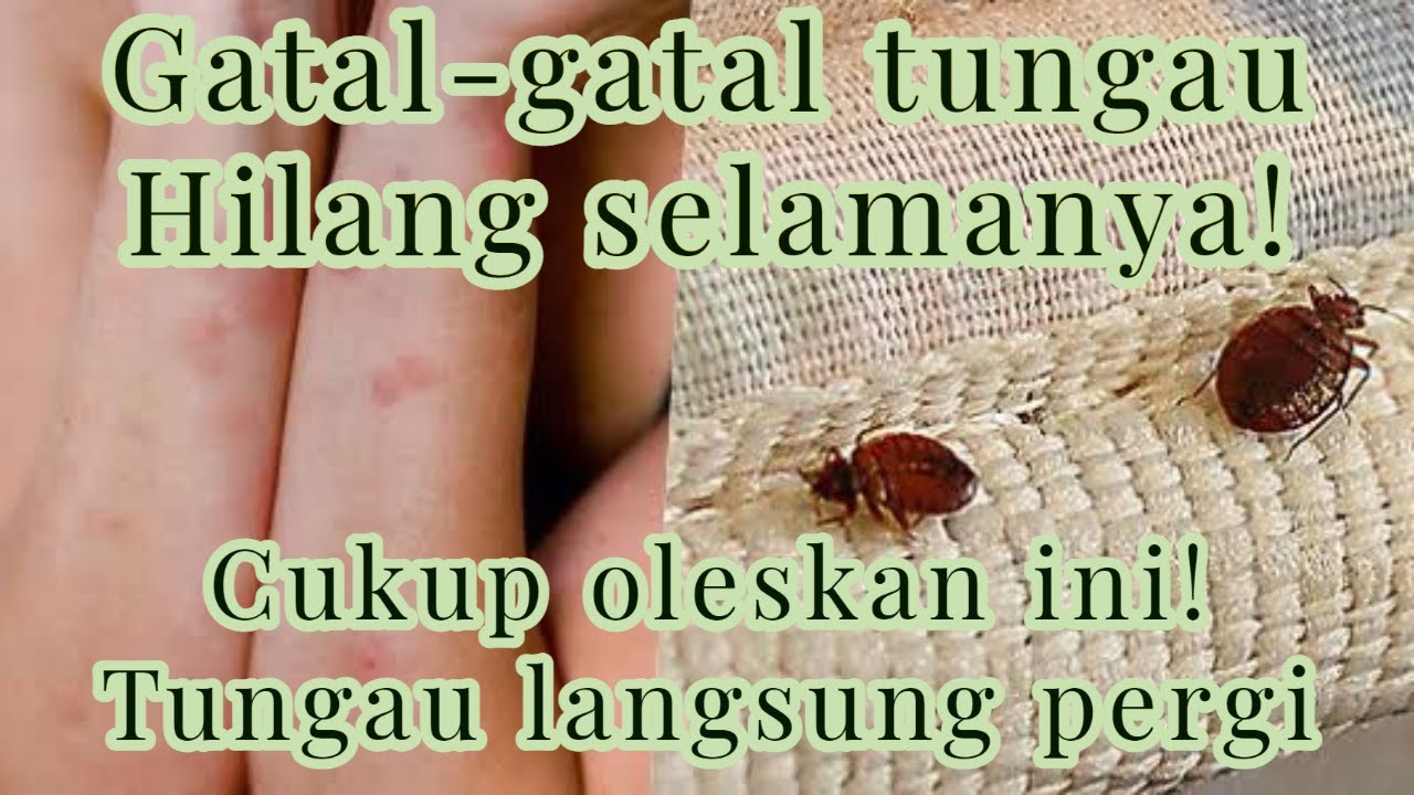 CARA MENGATASI GATAL GATAL TUNGAU PENGALAMAN PRIBADI 100% DAPAT ...