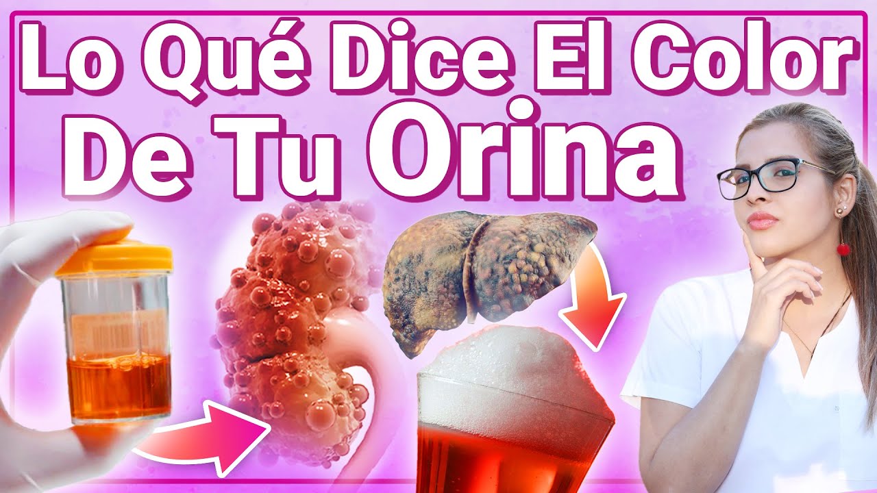El Color De Tu Orina Indica Enfermedad - Orina Amarilla, Clara, Roja Y ...