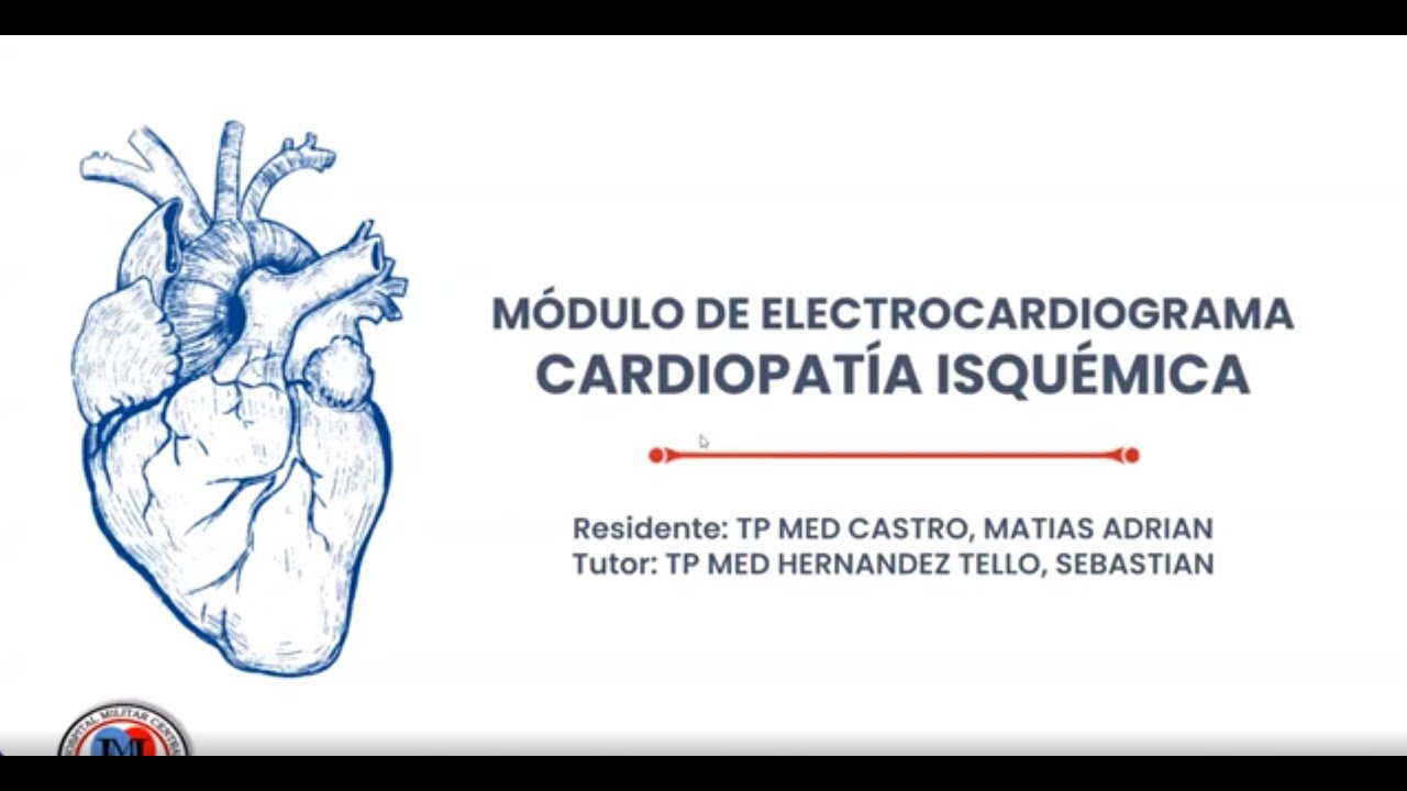 Electrocardiograma en cardiopatía isquémica - YouTube