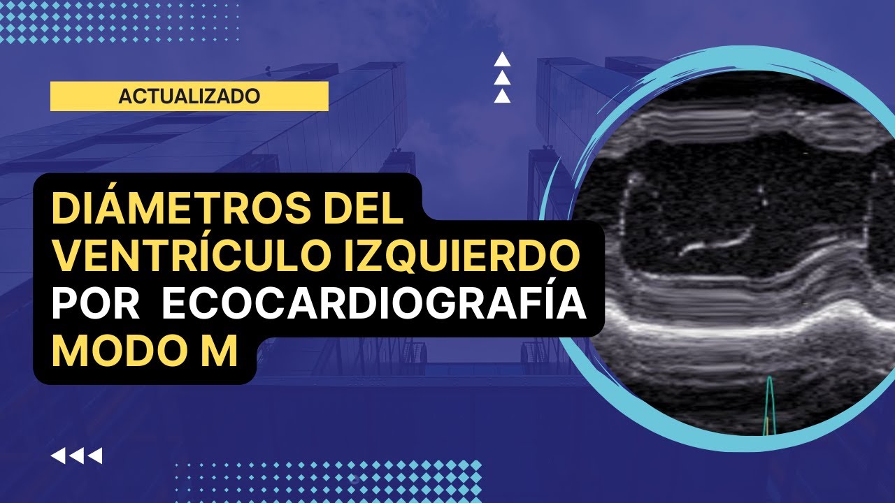 DIAMETROS DEL VENTRICULO IZQUIERDO por Ecocardiografía MODO M 💡 ...