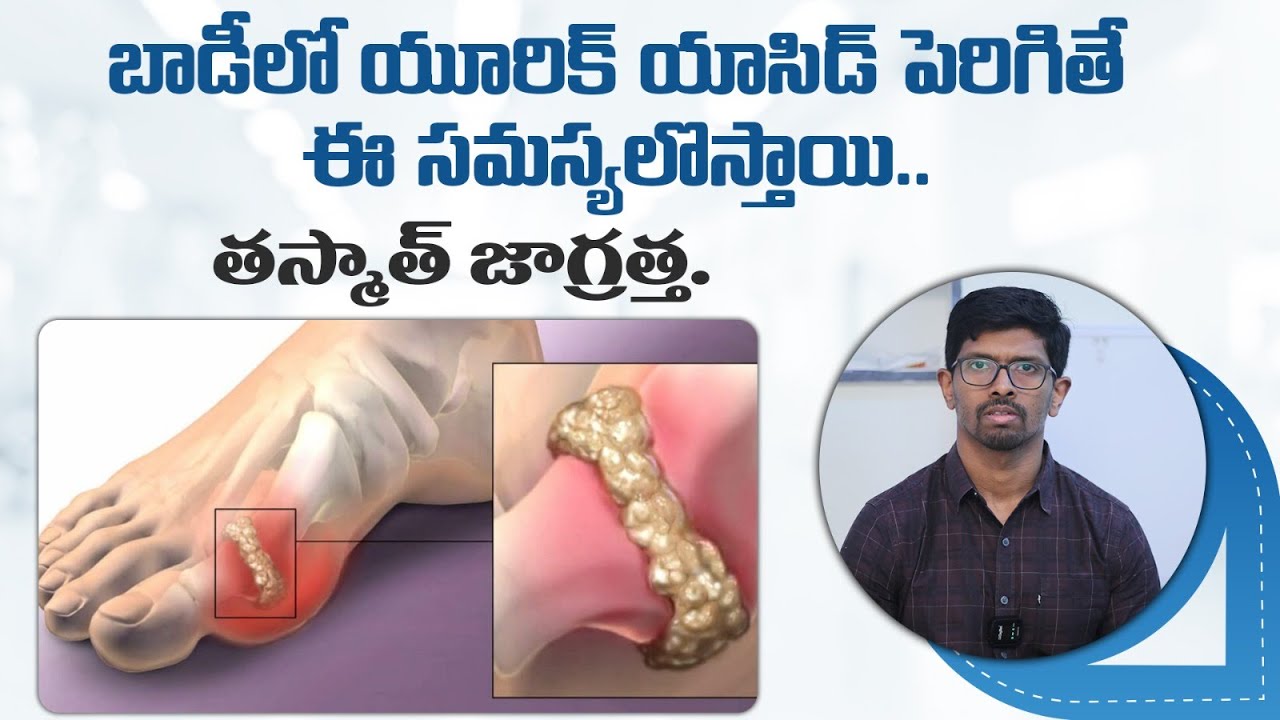 What is Uric Acid exactly | High Uric Acid | Causes | Treatment | Dr ...