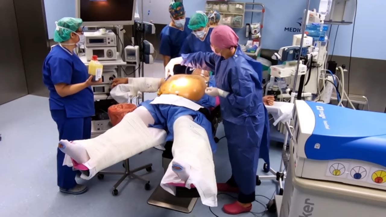 Operacja resekcji żołądka - jak wygląda jej przebieg? [Walka na ...