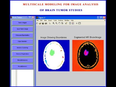 Multiscale Modeling for Image Analysis of Brain Tumor Studies Matlab ...