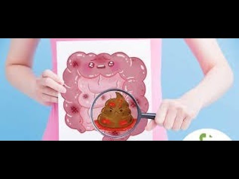 Steatorrhea, Fatty Stool, Fatty Feaces ; Definition, Causes, Symptoms ...