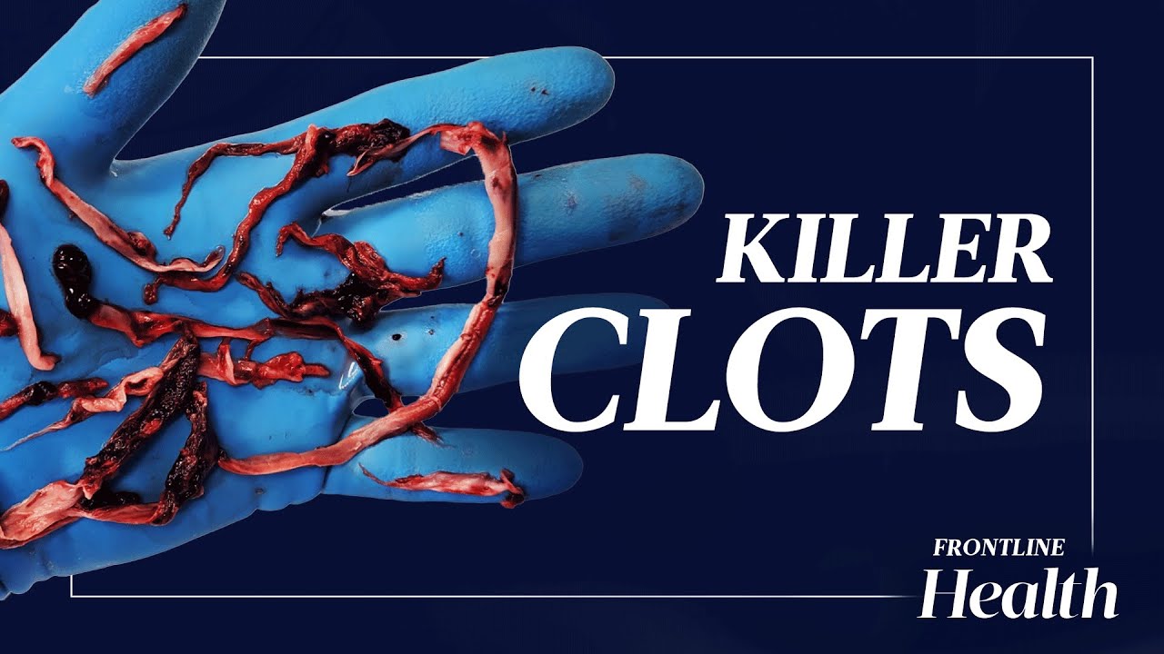 Mystery Clots Appear in 50–70 Percent of Deceased: Funeral Director ...