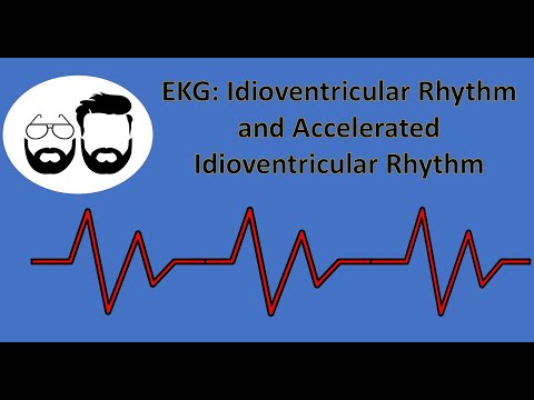 EKG Series: Idioventricular Rhythm, Accelerated Idioventricular Rhythm ...