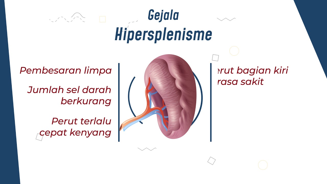 Hipersplenisme - YouTube