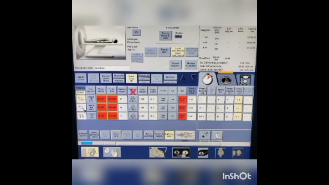 manejo software GE TCM - YouTube