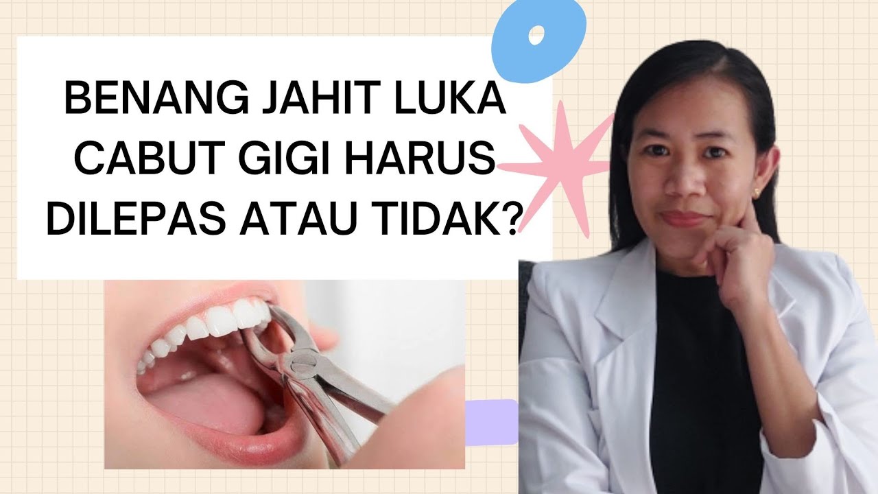 Benang jahit luka bekas cabut gigi harus dilepas atau tidak? - YouTube