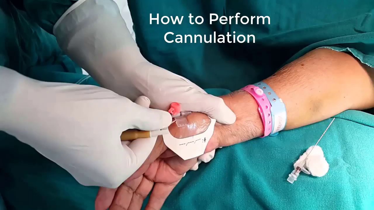 How to Perform Cannulation , Cannulation- How to gain IV access - YouTube