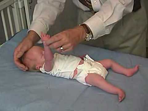 neurology exam: newborn-abnormal: Tone - Arm Traction - YouTube