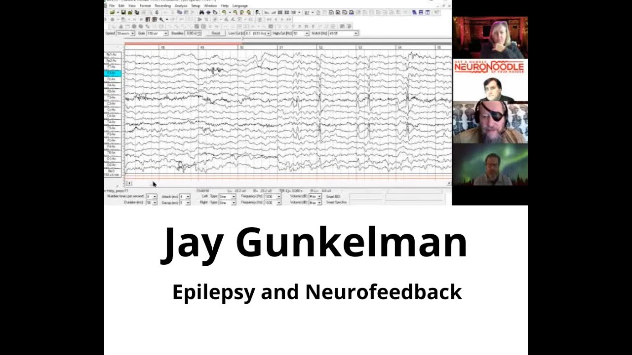 Jay Gunkelman "Epilepsy and Neurofeedback" NeuroNoodle Podcast Snippet ...
