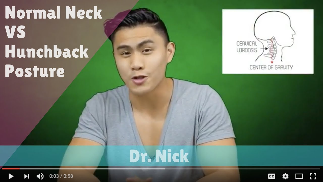 Normal Neck Curve VS Hunchback Posture - YouTube
