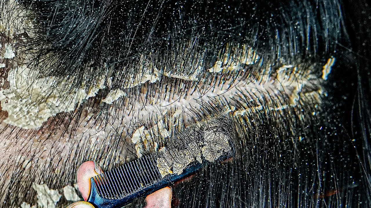 Ultimate Relaxation with Comb #MRK5805 - YouTube