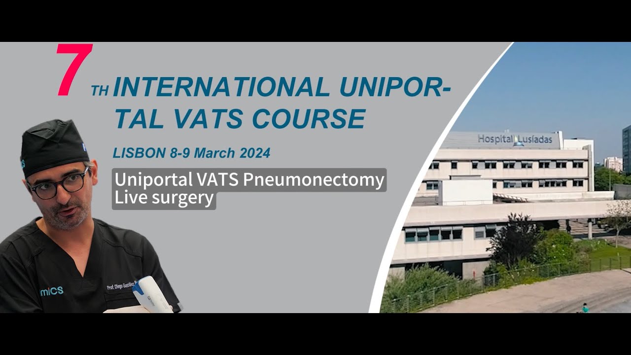 Panther 7th Uniportal VATS MC live surgery Pneumonectomy case2 by Dr ...