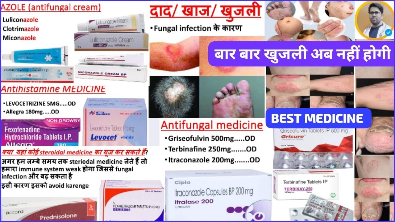 दाद खाज खुजली मैं यूज होने वाली दवाईयां/दाद खाज खुजली की सबसे BEST दवाई ...