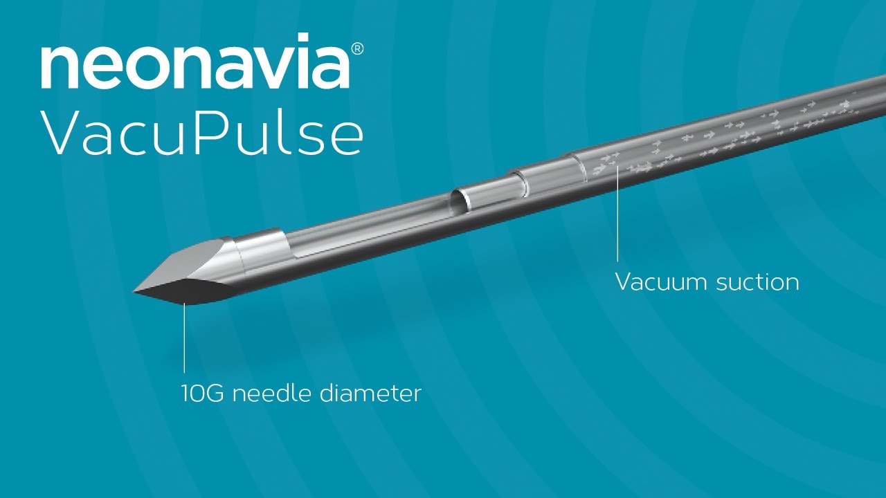 VacuPulse - a vacuum needle with pulse control (NeoNavia) - YouTube