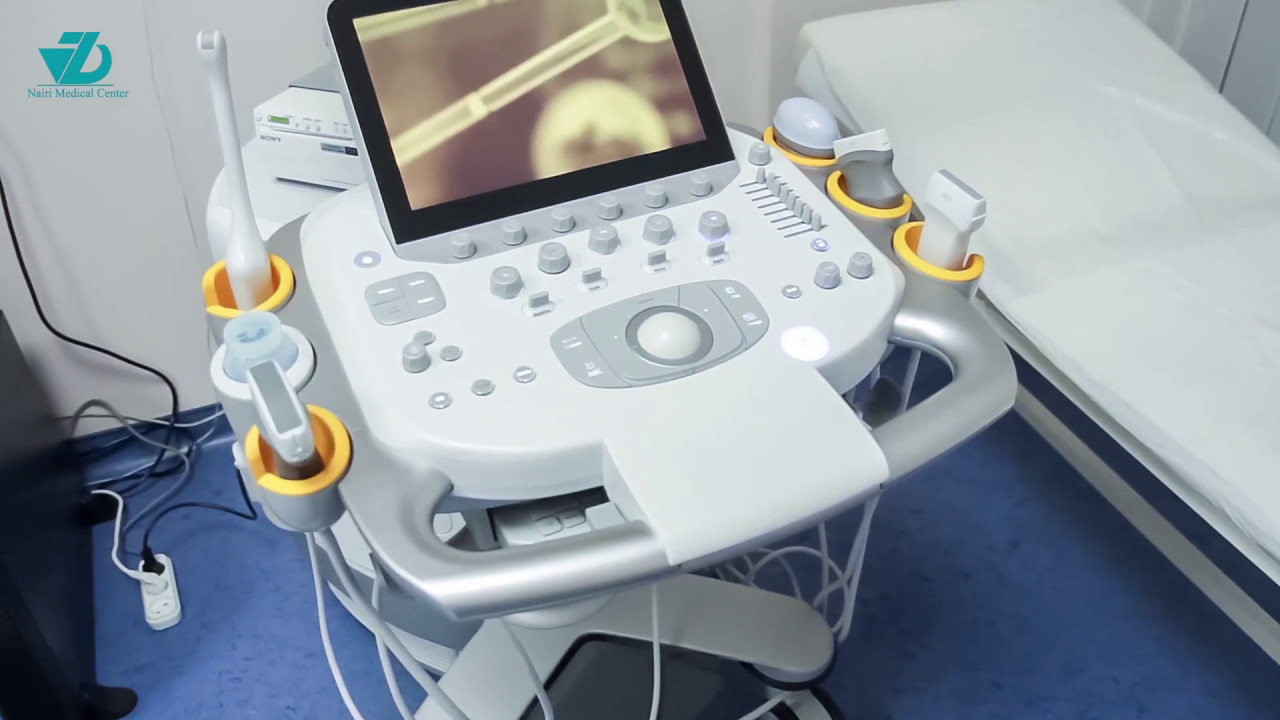 Innovative Ultrasound System ACUSON S3000 in Nairi MC - YouTube