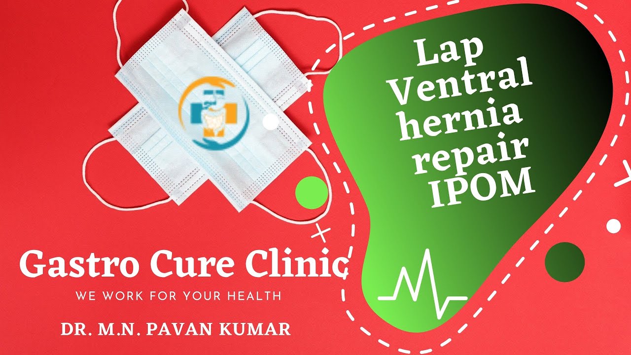 Lap Ventral hernia repair IPOM - YouTube