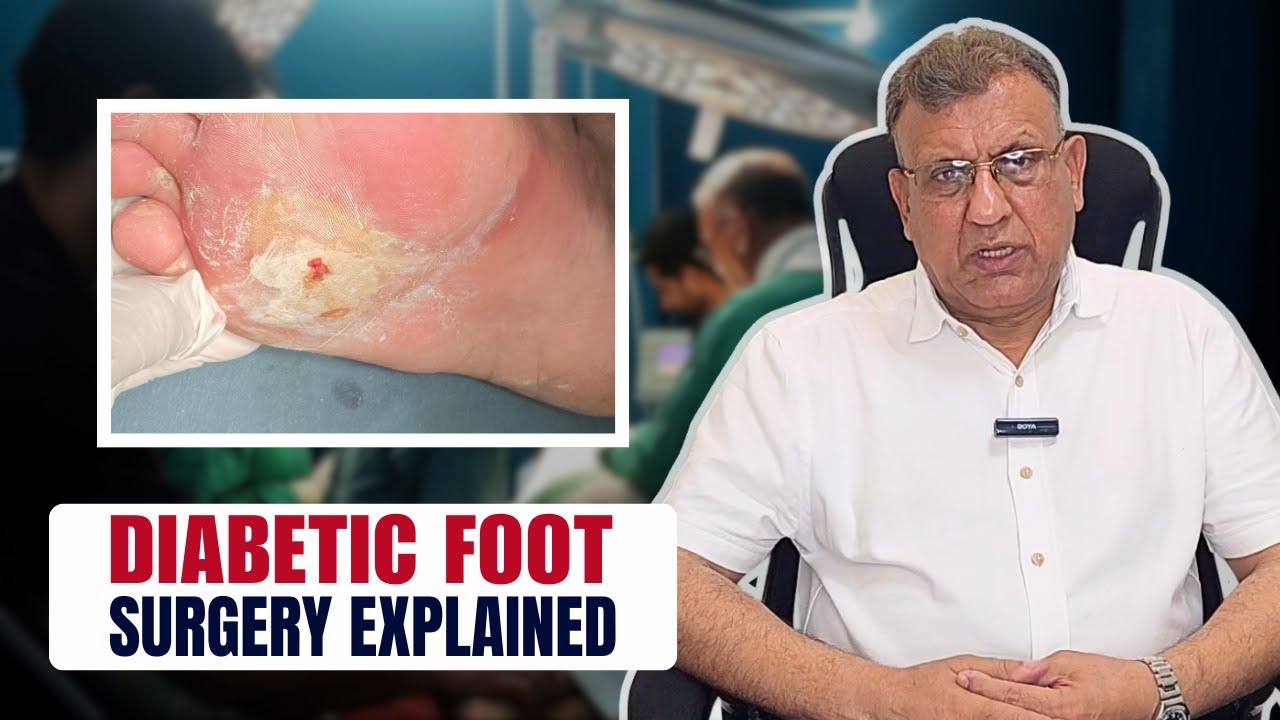 Diabetic Foot Surgery at Sugar General Hospital - YouTube