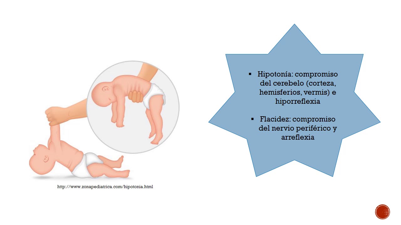 Tono muscular - YouTube