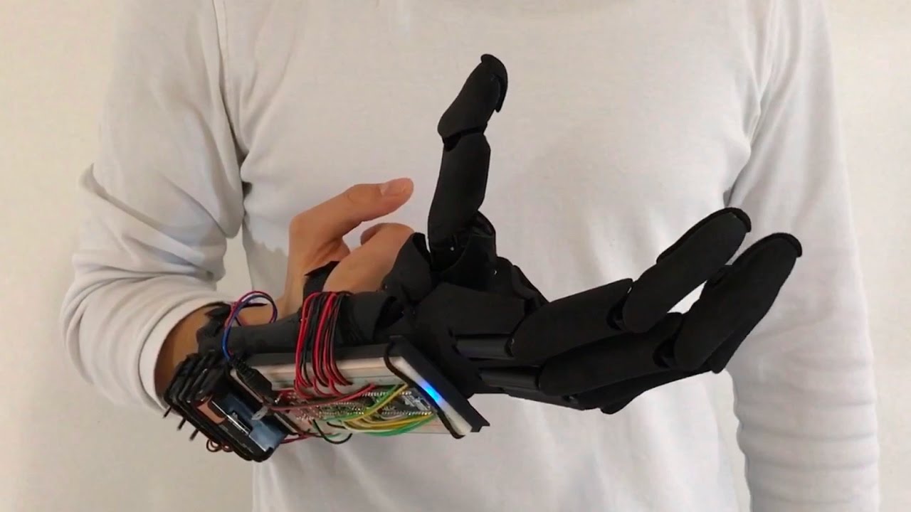 Youbionic Hand Commercial - YouTube