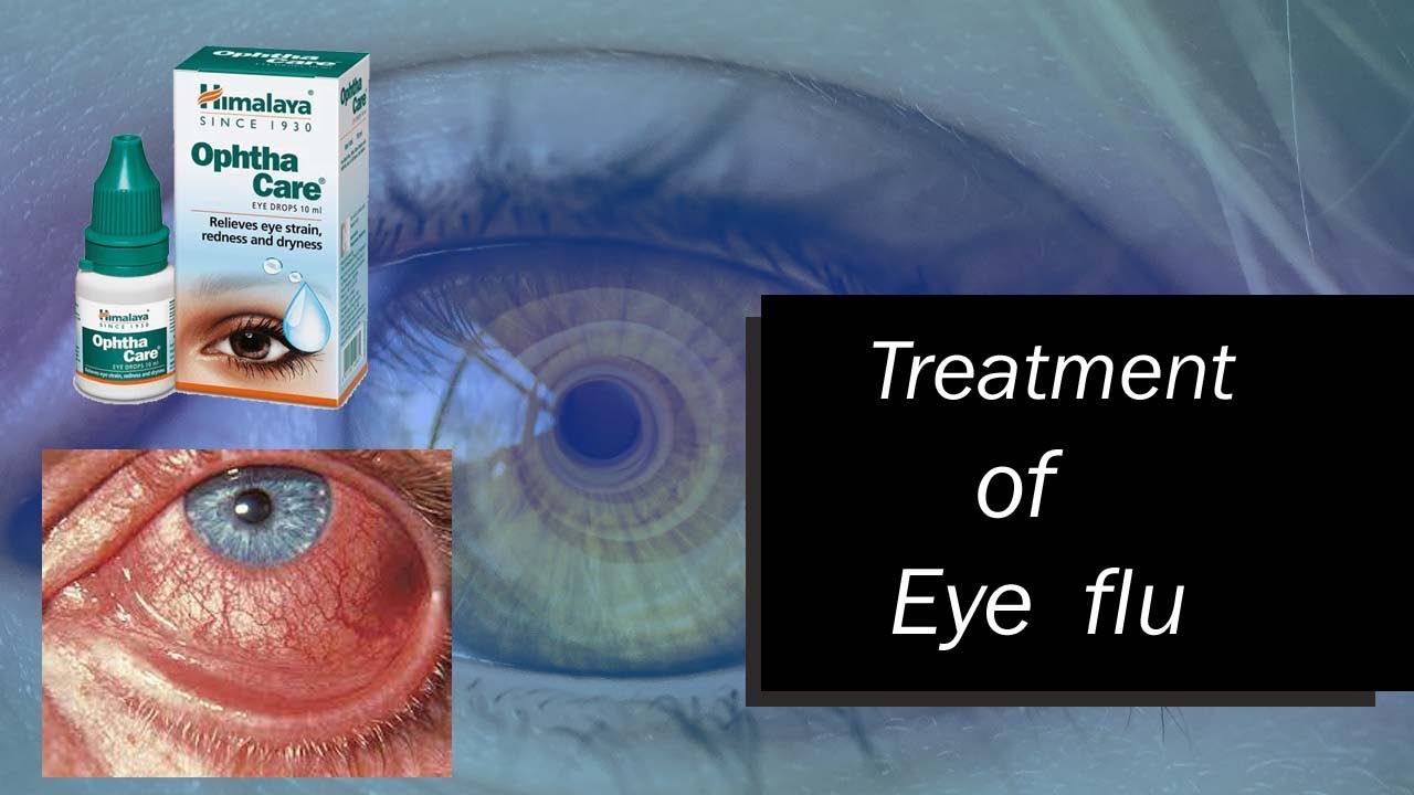 Best Treatment of Eye flu. - YouTube