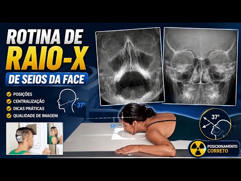 RAIO-X ROTINA PARA SEIOS DA FACE WATERS, CALDWELL E PERFIL