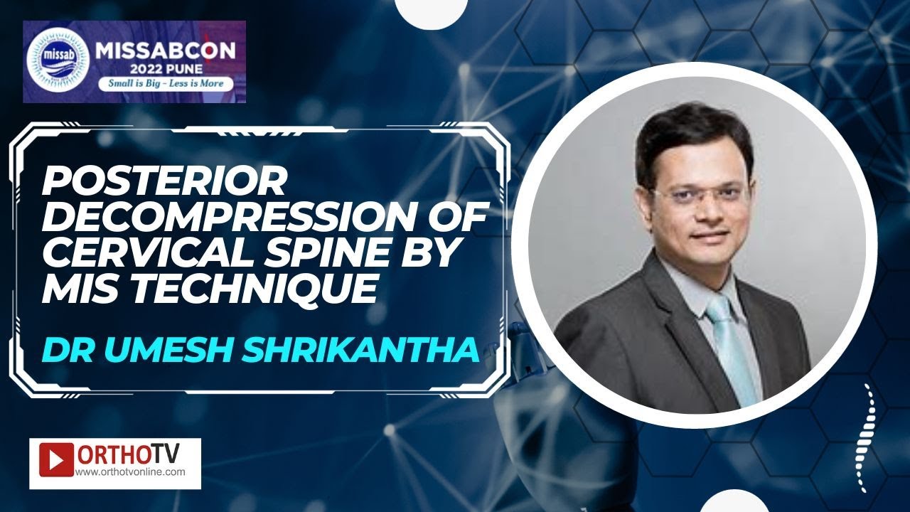 Posterior decompression of Cervical Spine by MIS Technique - Dr Umesh ...