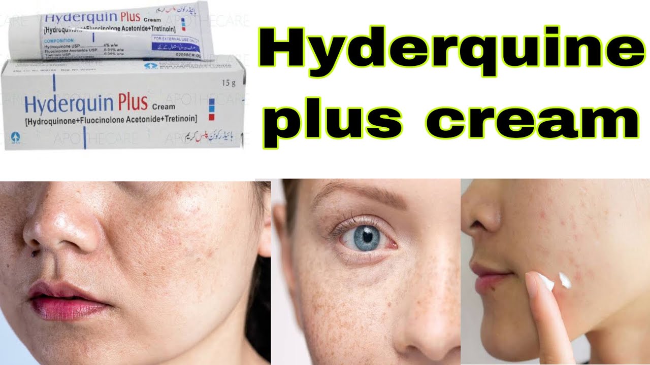 Hyderquine plus cream uses | How to use hyderquine plus cream for ...