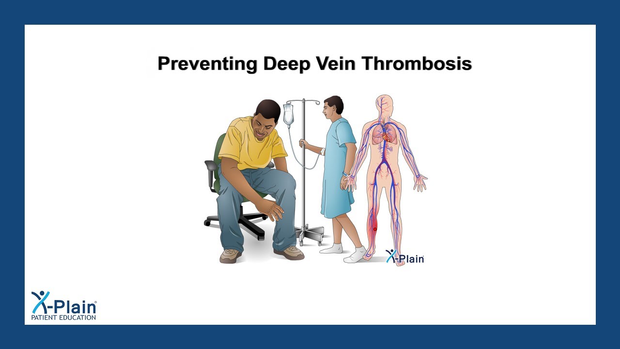 Preventing Deep Vein Thrombosis - YouTube