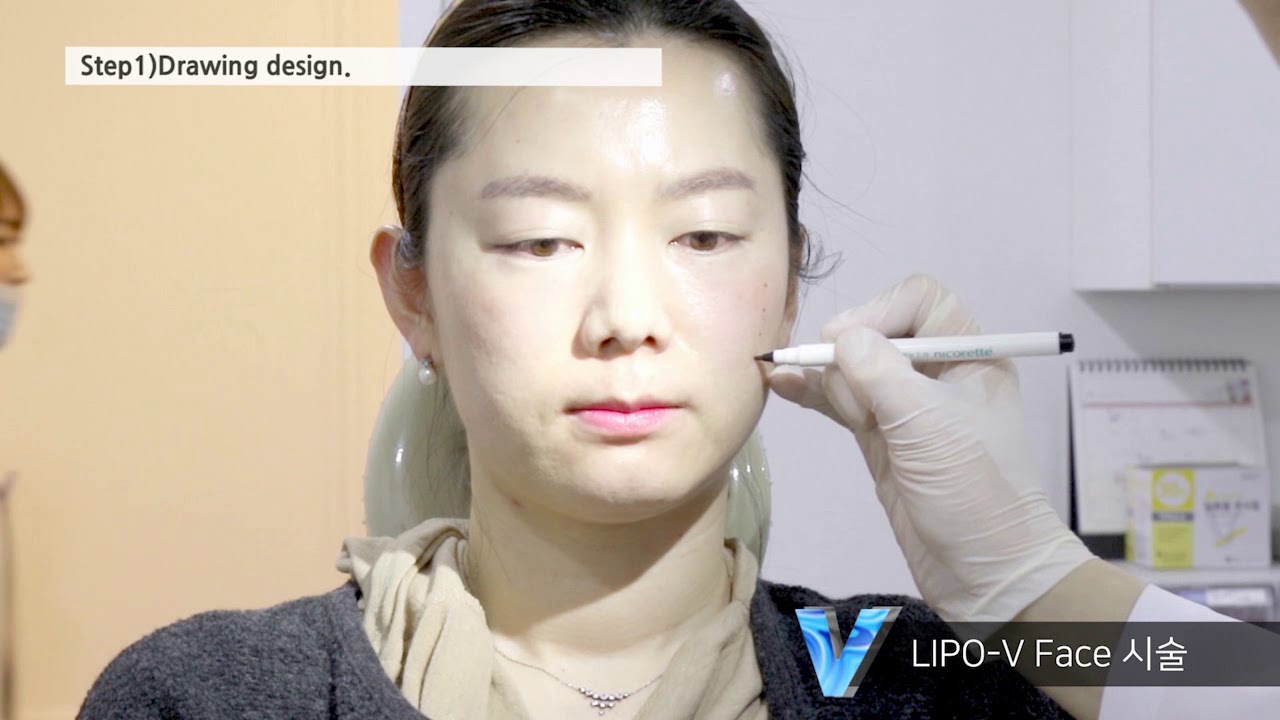 Lipo V Face & Body demonstration - YouTube