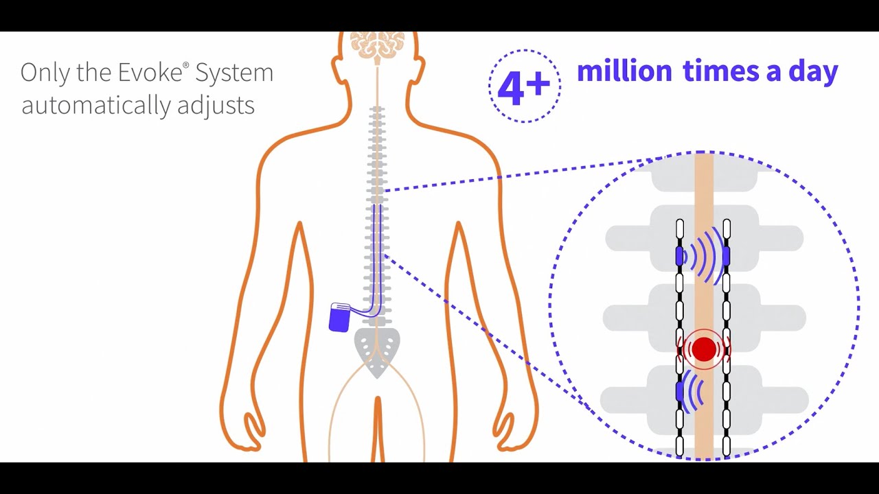 How SmartSCS Works - YouTube