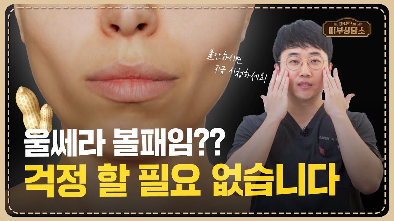 울쎄라 리프팅 부작용 볼패임 과연 왜 생길까 울쎄라 부작용 볼패임 해결방법 Youtube