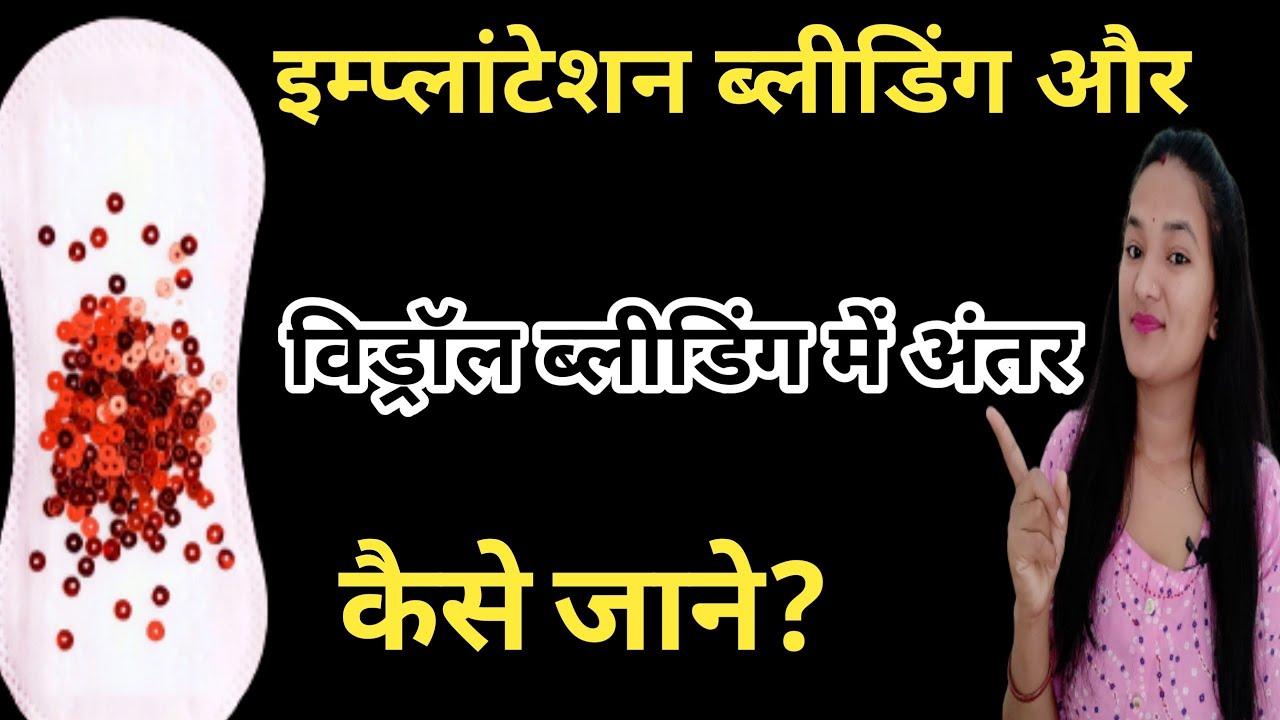 Difference Between Implantation Bleeding and Withdrawal Bleeding ...