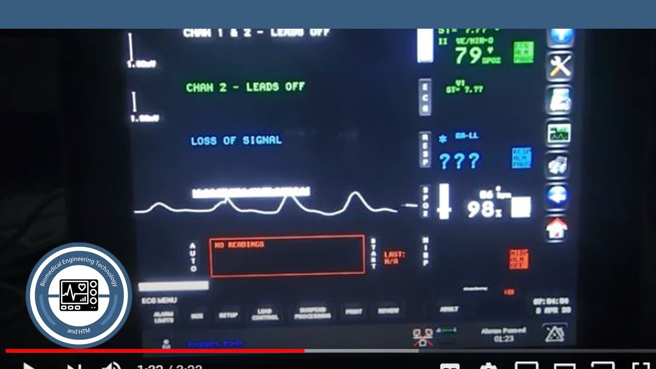 Spacelabs Qube: Patient Monitor Testing - YouTube