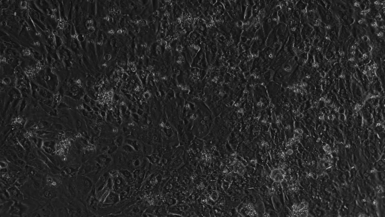 Axol Human iPSC derived Atrial Cardiomyocytes Day 5 - YouTube