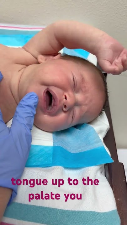 Milk tongue? Exercises we can do to help with that - YouTube