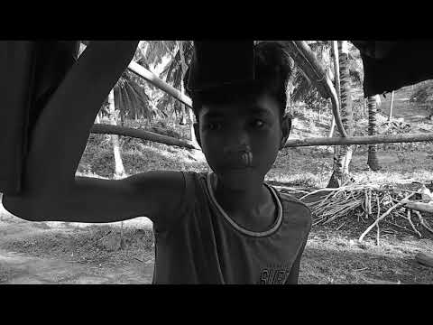Tour town glan.(operation tuli + albularyo)