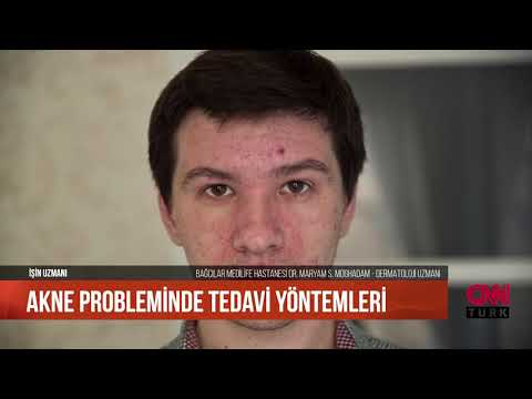 İŞİN UZMANI / AKNE TEDAVİSİ - UZM. DR. MARYAM SEYDİ MOGHADAM