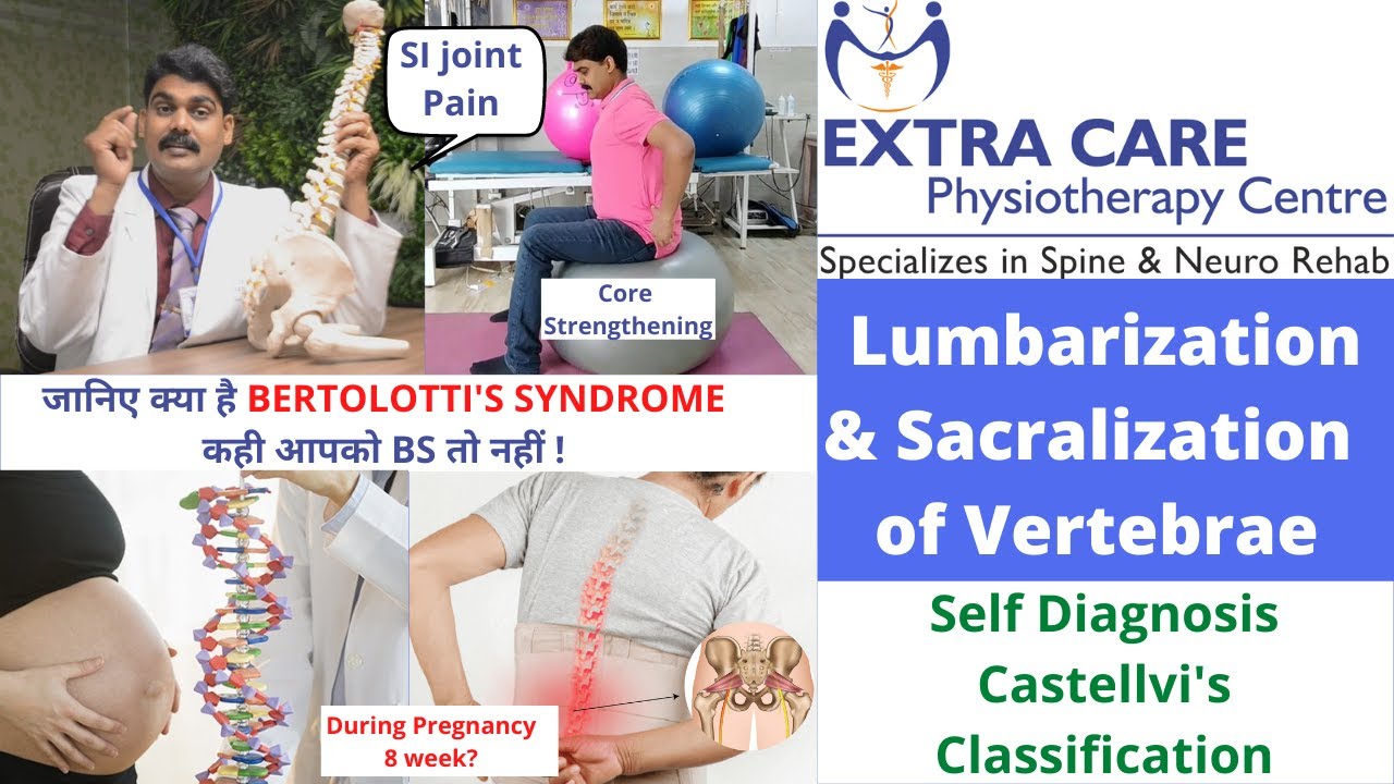 Lumbarization & Sacralization (L5-S1) of Vertebrae | Self Diagnosis ...