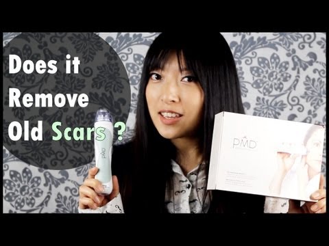 DOES IT REMOVE OLD SCARS? PMD PERSONAL MICRODERM REVIEW BEFORE & AFTER ...