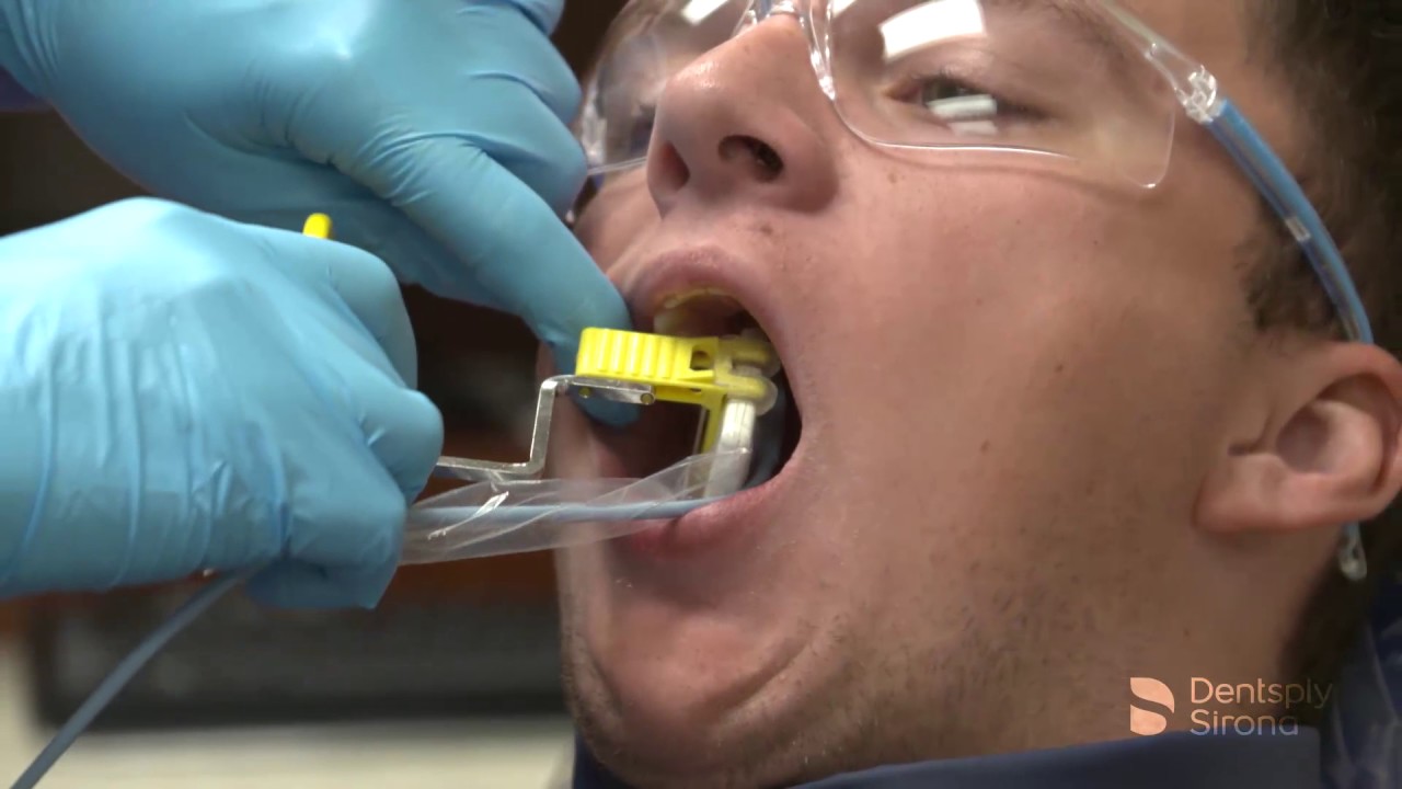 RINN XCP Short Arm Posterior Placement | Dentsply Sirona - YouTube