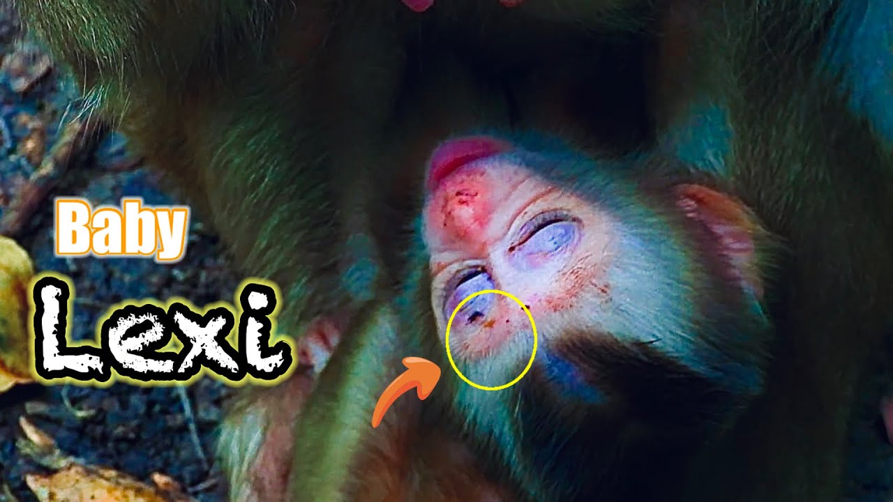 What happened..? Newborn 6 days ago Lexi baby..!! Come to know __how to ...