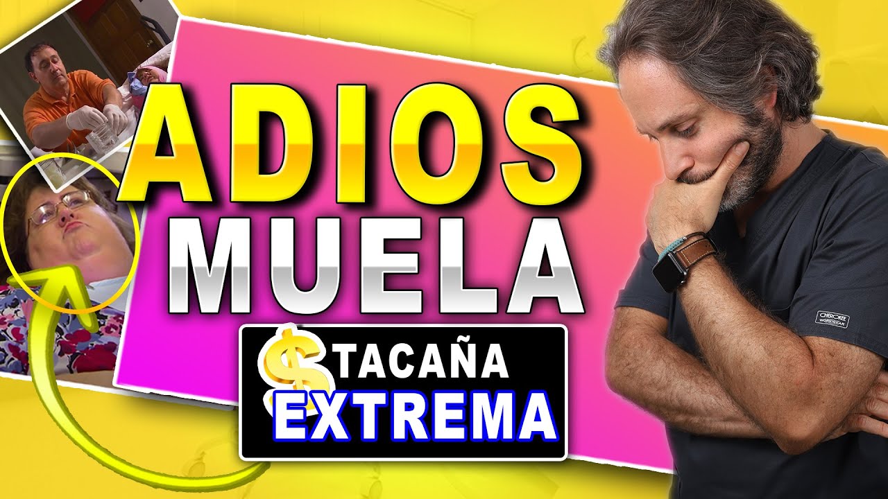 🟣Cómo SACARSE una MUELA en casa SIN QUE DUELA - El Reto de la TACAÑA ...
