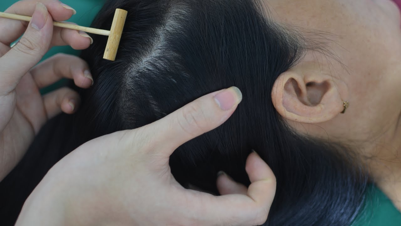 Asmr Tingly Scalp Scratching Scalp Massage Hair Parting Hair Scratch