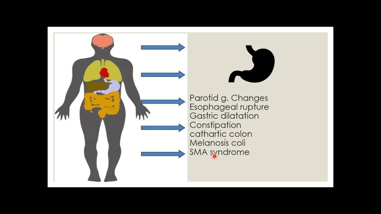 Radiology of eating disorders - YouTube