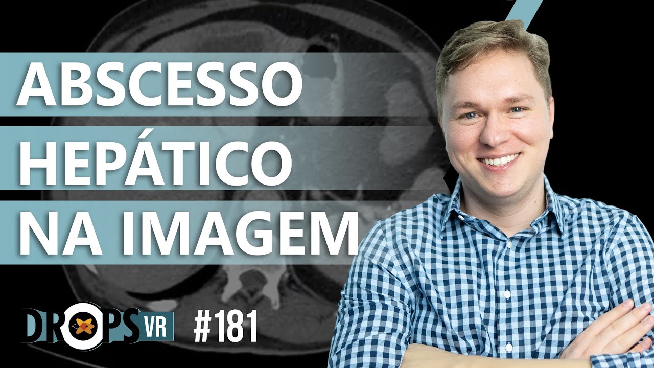 ABSCESSO HEPÁTICO NA IMAGEM - IDENTIFICANDO NA TC - YouTube